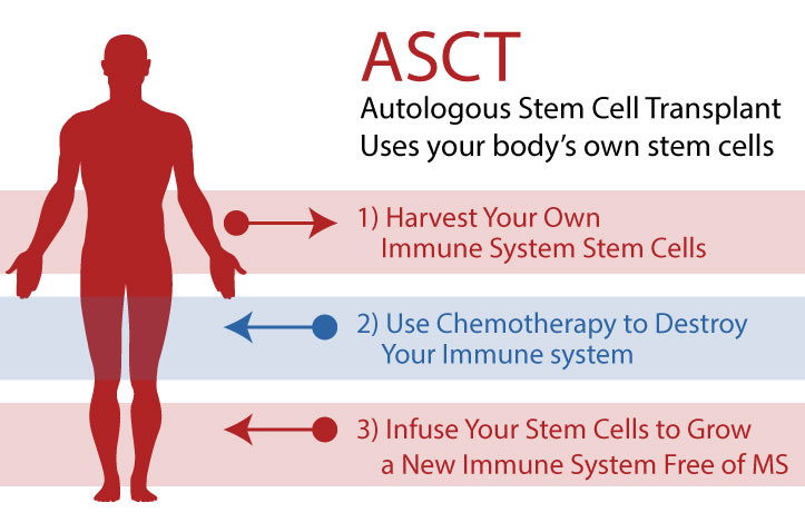 HSCT – A Life with multiple sclerosis